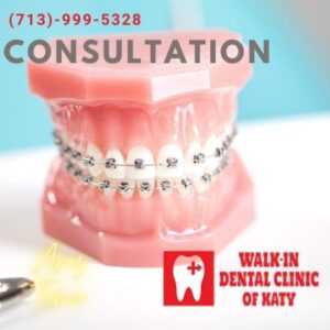 Dental Braces and It's types, Braces cost and braces treatment in ...